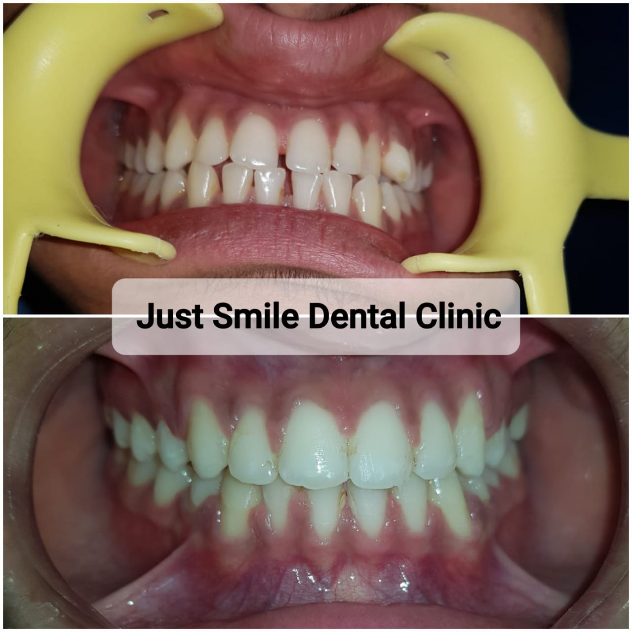Just Smile Dental Clinic Photo Gallery